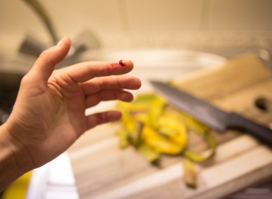 5 of the most common injuries in the home... and how to treat them